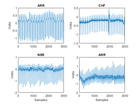 Time Series Analysis: Steps, Types, and Examples - MATLAB & Simulink