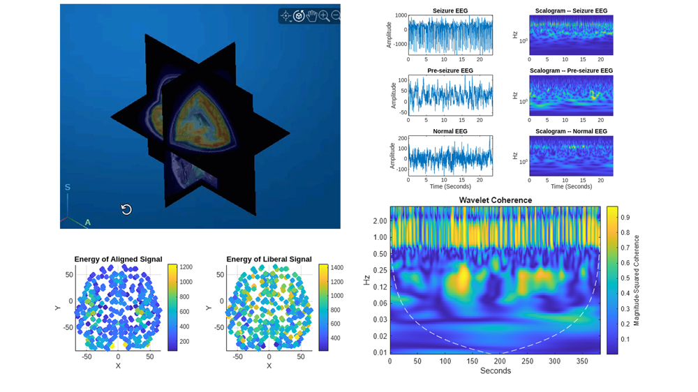 Neuroscience - MATLAB and Simulink Solutions - MATLAB & Simulink