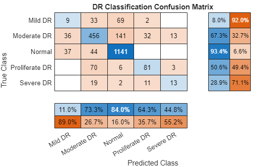 Multilabel Diabetic Retinopathy Fundus Image Classification Using Deep Learning - MATLAB & Simulink